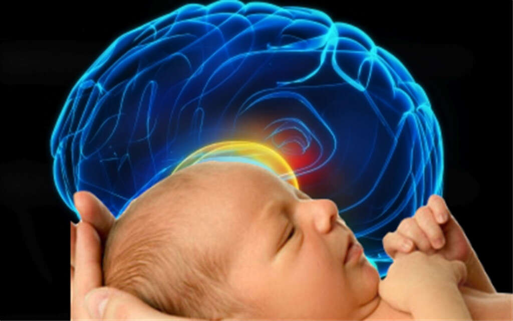 Nystagmus 10 Causes Of Nystagmus Nystagmus 10 Causes Of Nystagmus