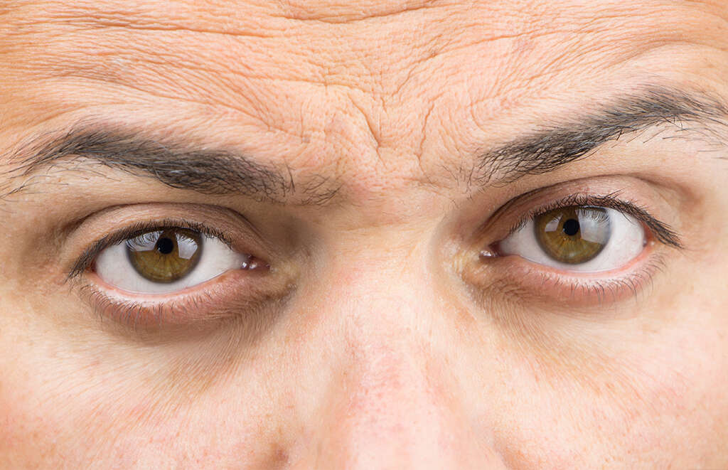Dehydration 10 Signs Of Dehydration