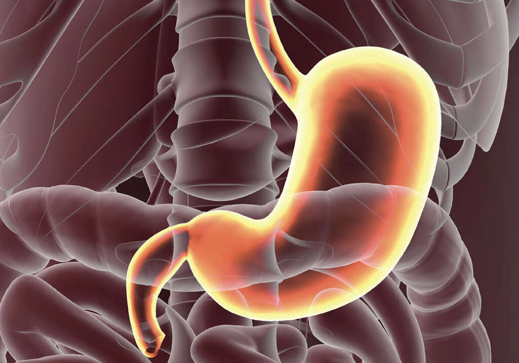 Gastrointestinal Disease What Is Gastrointestinal Disease 