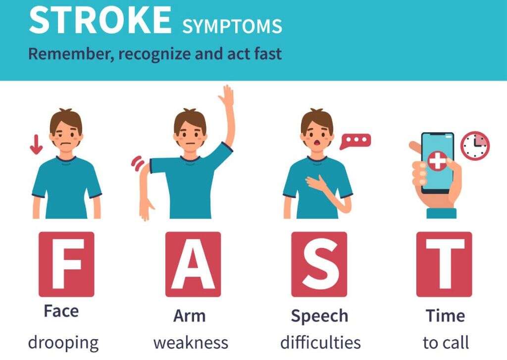 Ischemic Stroke What Is An Ischemic Stroke 